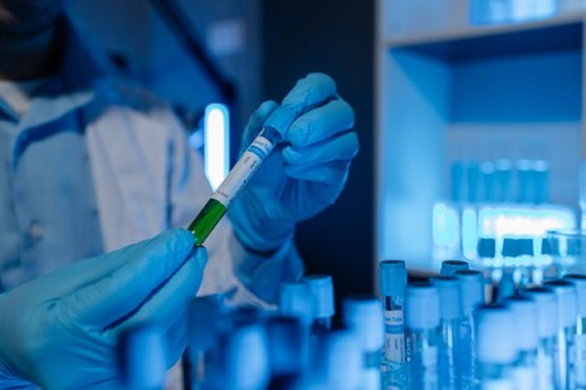 Role of Lab Testing in Functional Medicine | Restoration Healthcare